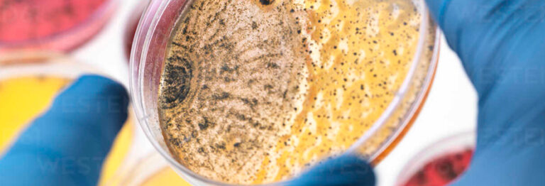 La biocontamination des locaux professionnels